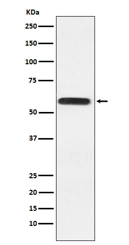 Lgi1 Rabbit mAb_RayBiotech